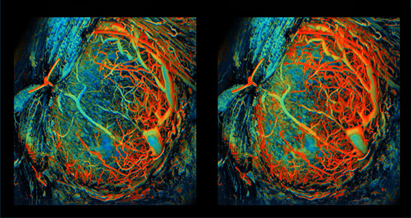Optics & Photonics News - A Photoacoustic View of a Mouse Placenta