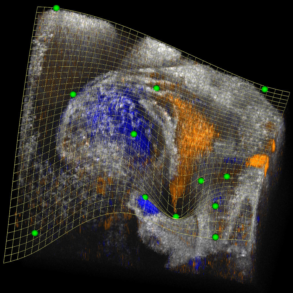 Optics & Photonics News - Better 3D and 4D Visualization of Biomedical ...